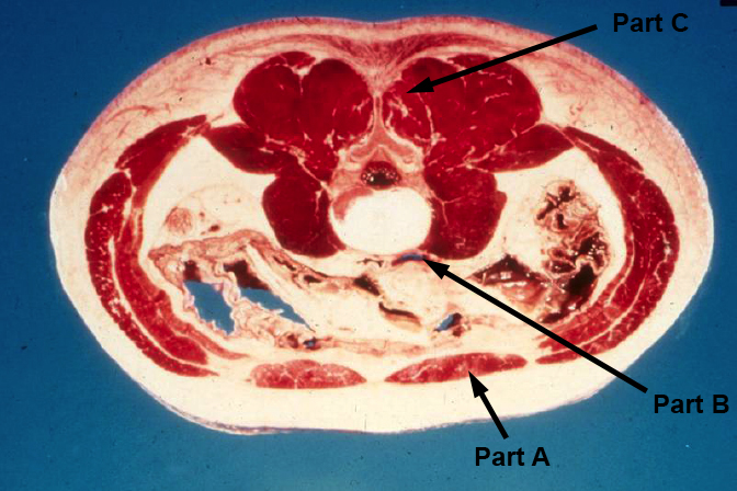 Solved PART A: Identify the muscle at the tip of the arrow. | Chegg.com