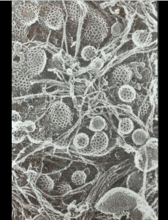 Solved RNPS 6 | Chegg.com