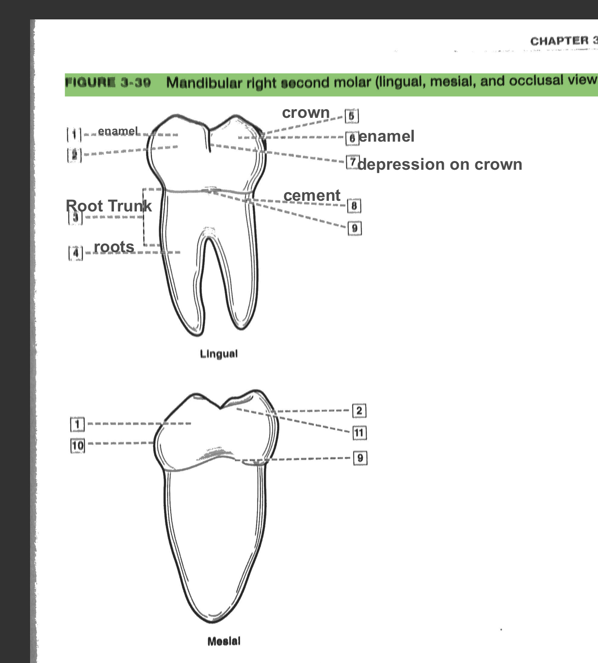 Solved Dental anatomy for Mandibular right second molar | Chegg.com