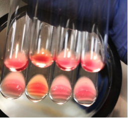 The following photos are ABORh Forward Typing Tube | Chegg.com