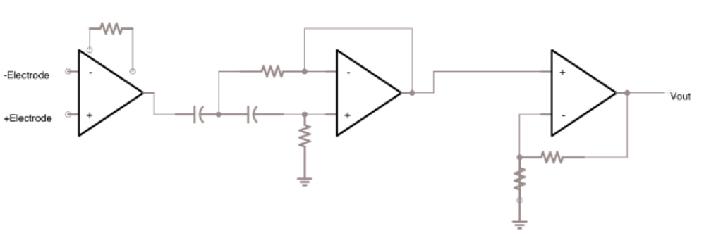 Solved This a prototype electrocardiogram (ECG) | Chegg.com