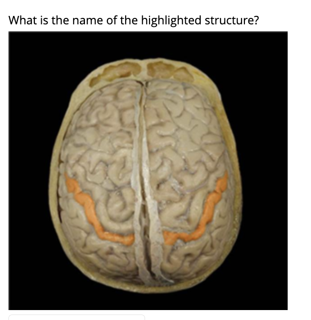 Solved What is the name of the highlighted structure? | Chegg.com