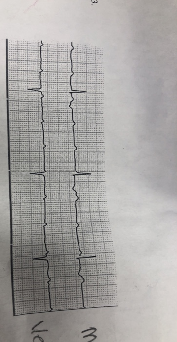 Solved 10. Id entify the traces and identify which trace is | Chegg.com
