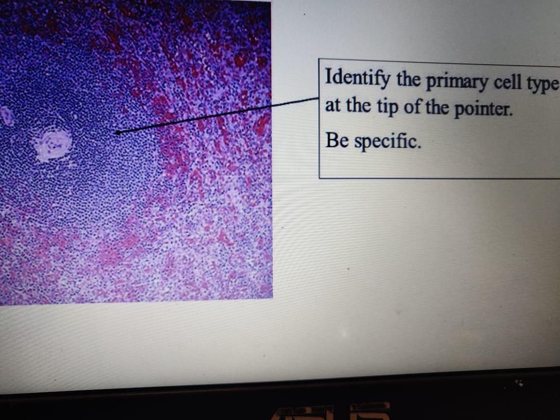 Solved Identify the region & organ at ti tip of the pointer. | Chegg.com