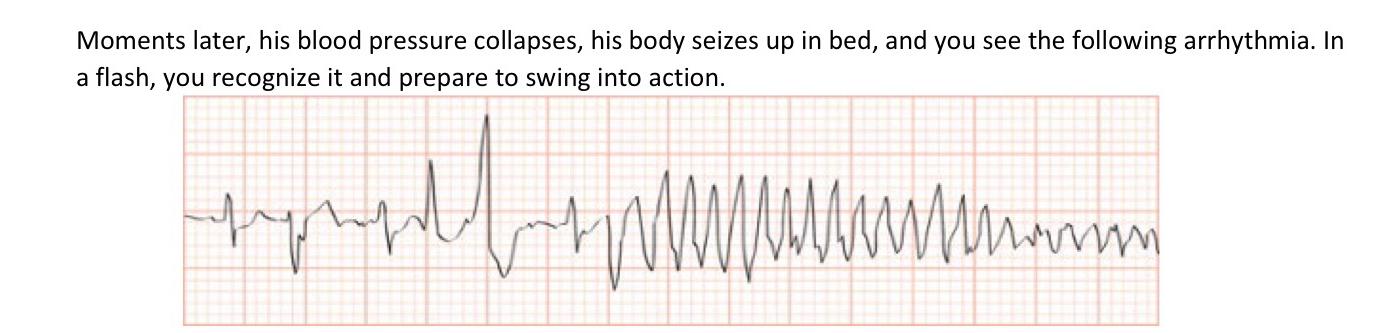 Solved It seems that a PVC landed on a QT interval and | Chegg.com
