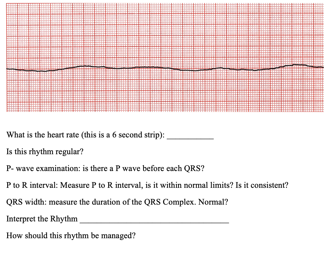Solved What is the heart rate (this is a 6 ﻿second strip):Is | Chegg.com