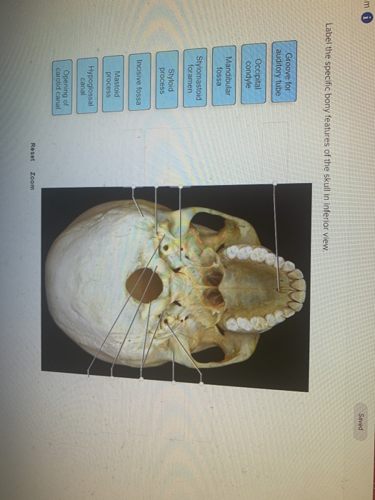 Solved /flow/connect.html features of the skull in inferior | Chegg.com