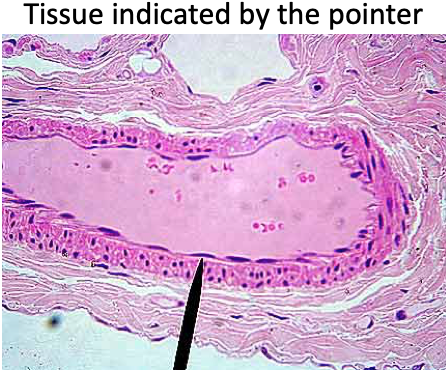 Solved Tissue indicated by the pointer | Chegg.com