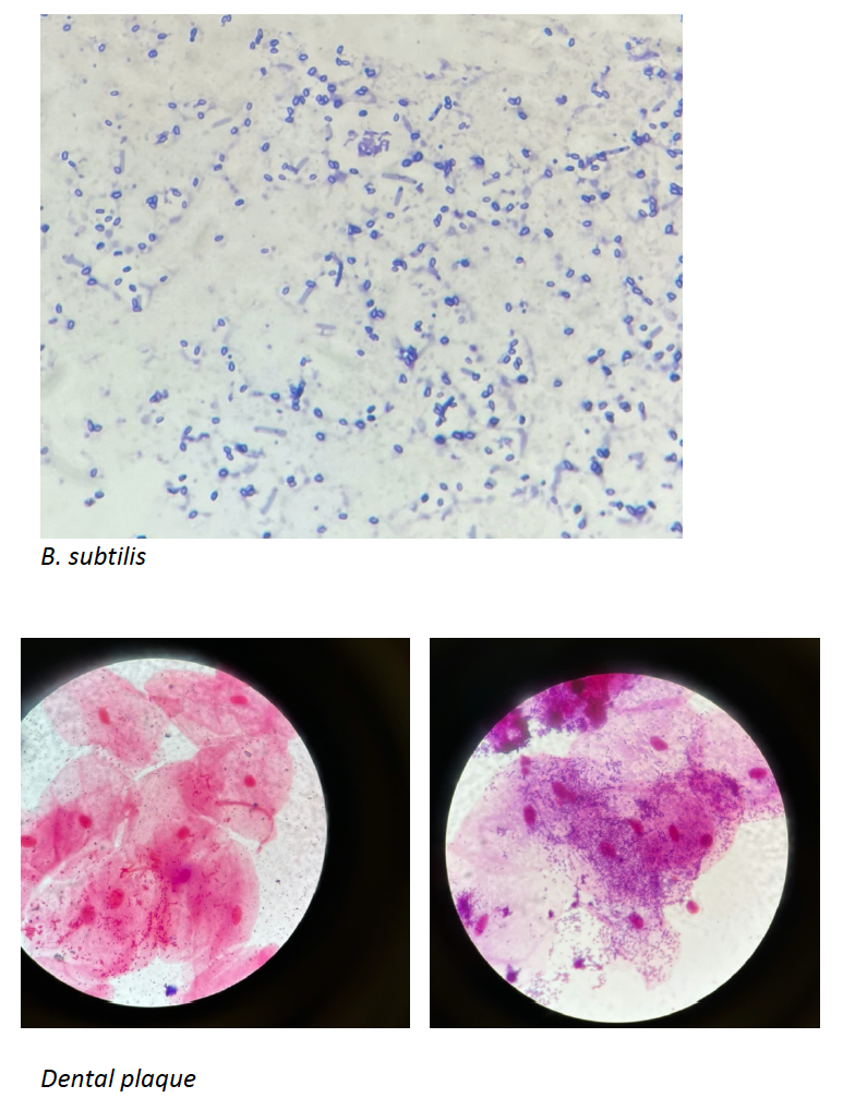 Pseudomonas Aeruginosa Gram Stain
