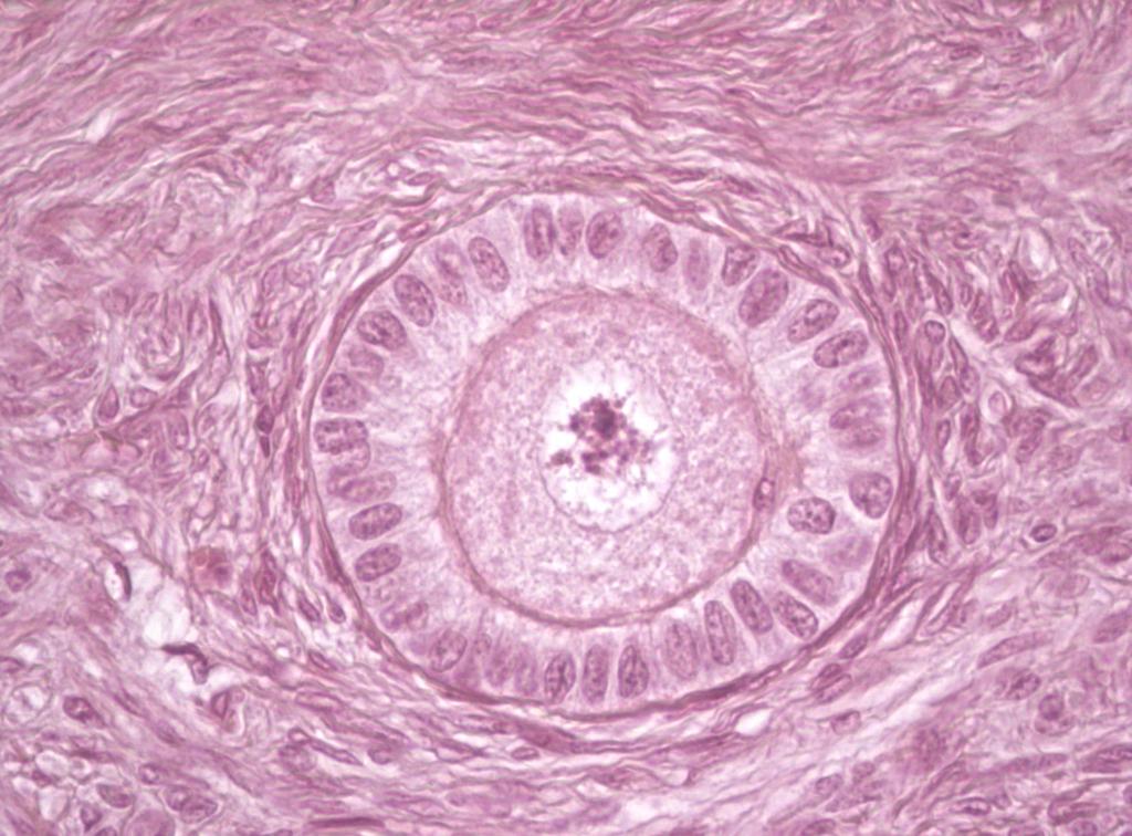 Solved Label the following structures ON BOTH PICTURES | Chegg.com