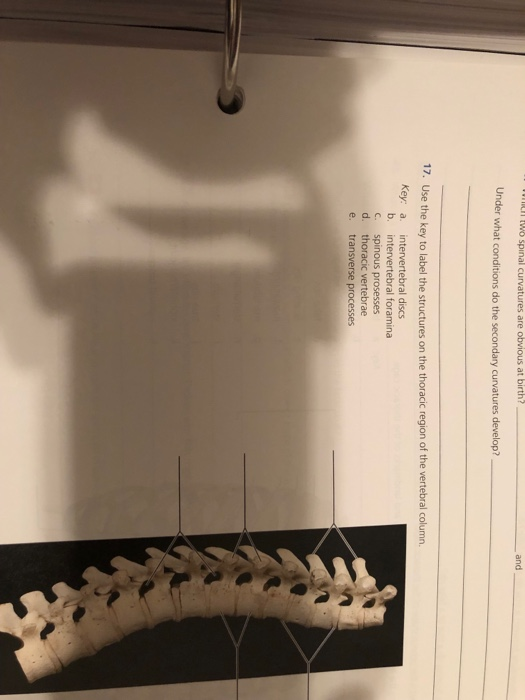 Solved 3. Define suture 4. With one exception, the skull | Chegg.com