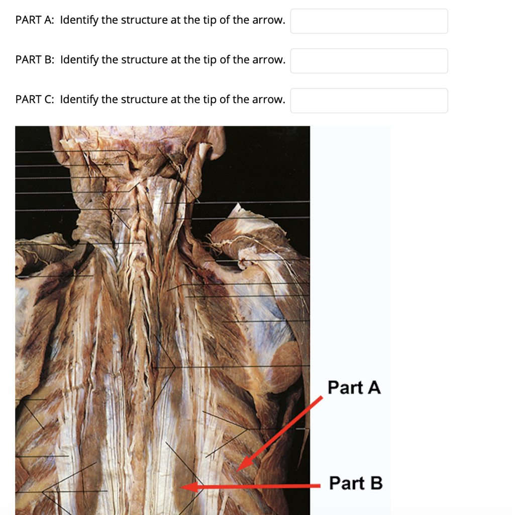 Solved PART A: Identify the structure at the tip of the | Chegg.com
