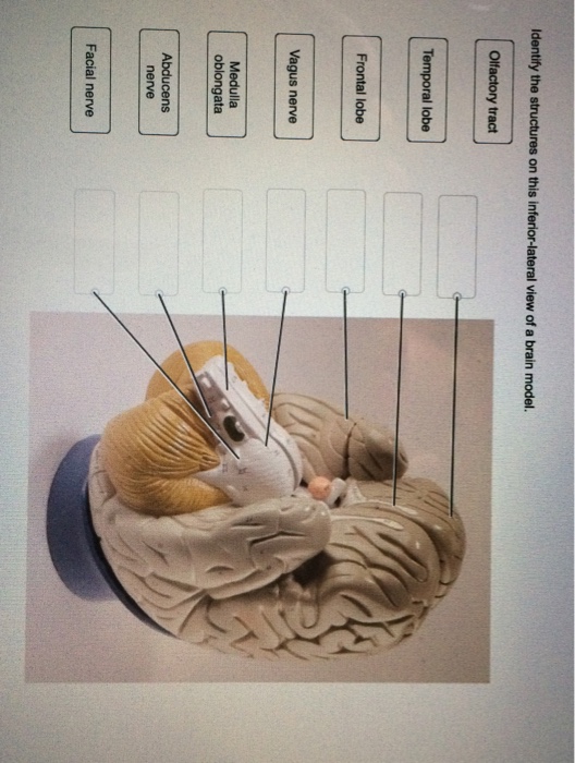 Solved Identify the structures on this inferior-lateral view | Chegg.com