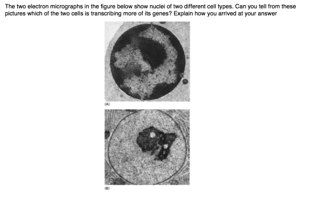 Solved The two electron micrographs in the figure below show | Chegg.com