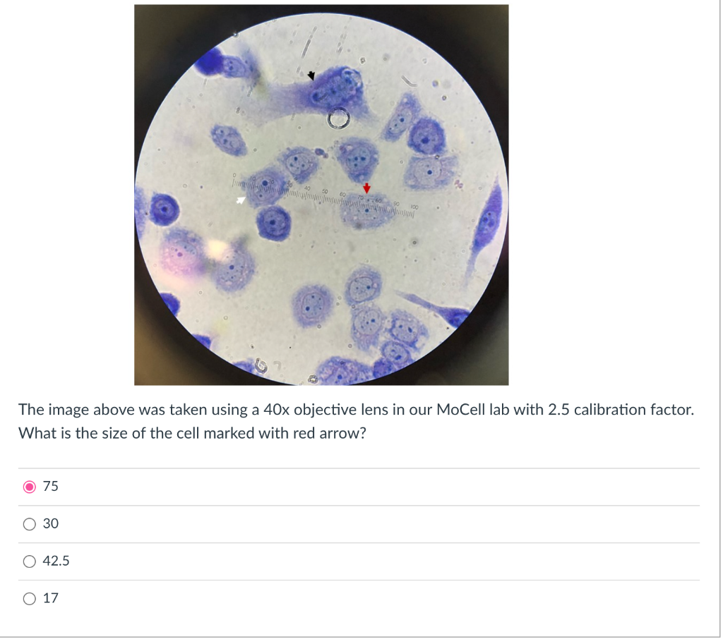 Solved The image above was taken using a 40x objective lens | Chegg.com
