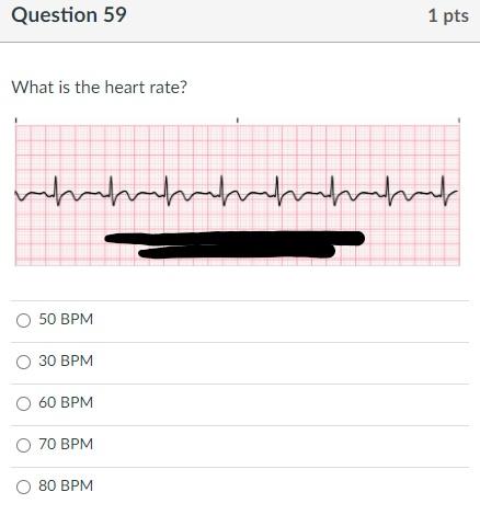 Solved Question 58 What is the heart rate? 1 pts بل للسلسل O | Chegg.com