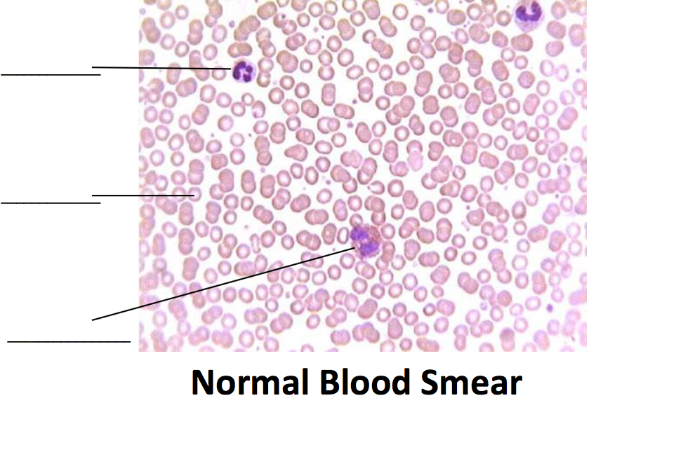 Solved A B D and Dx: Normal blood smear Vod Normal blood | Chegg.com