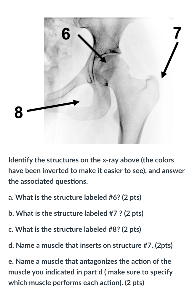 Solved Identify the structures on the x-ray above (the | Chegg.com