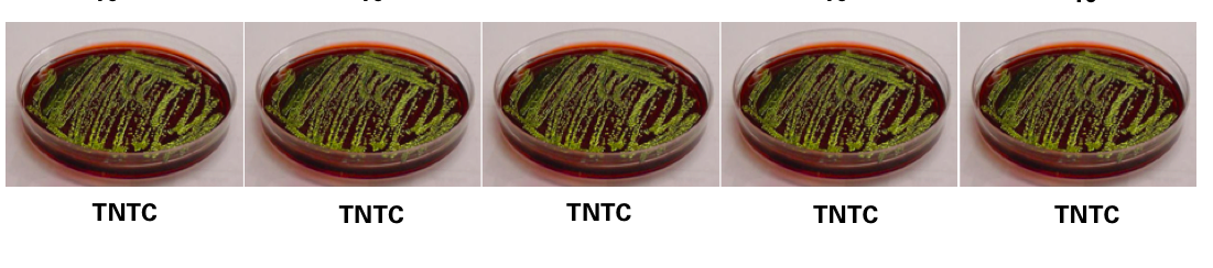 Solved TNTC TNTC TNTC TNTC TNTc | Chegg.com