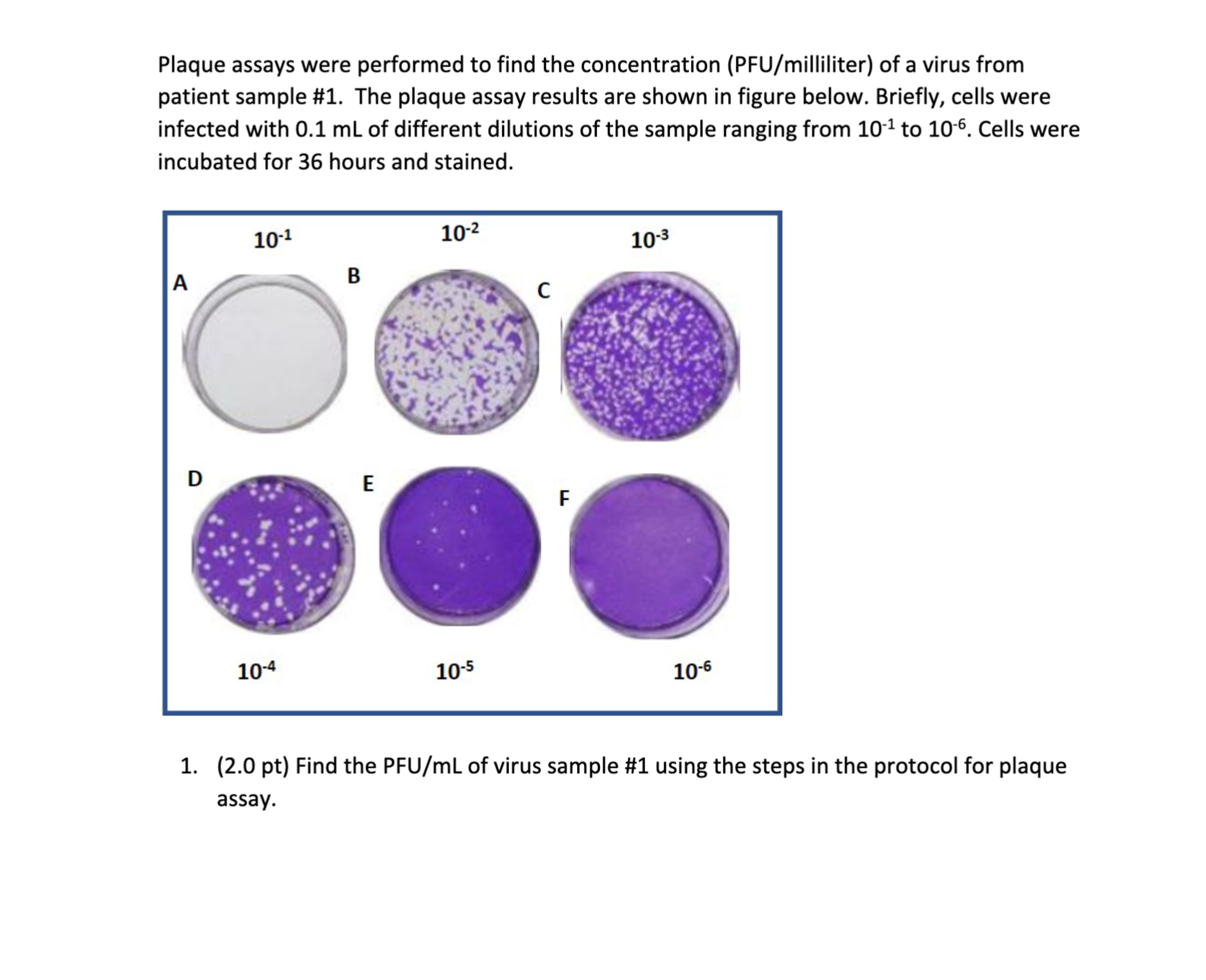 Solved Plaque assays were performed to find the | Chegg.com