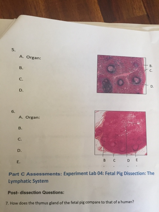 Solved How does the thymus gland of the fetal pig compare | Chegg.com