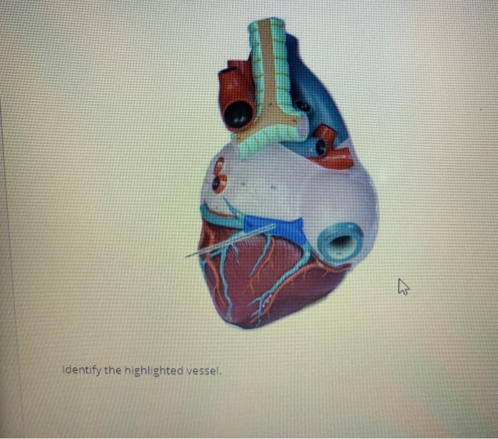 Solved Identify the highlighted vessel. Identify the | Chegg.com