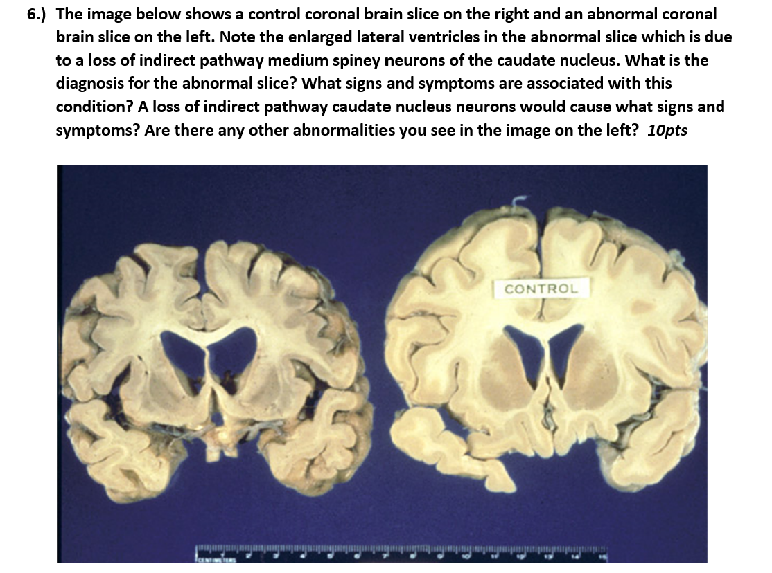Solved The image below shows a control coronal brain slice | Chegg.com