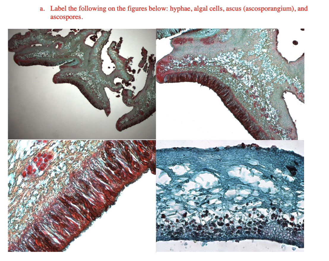 Solved Observe slide of the lichen Physcia. b. Classify the | Chegg.com