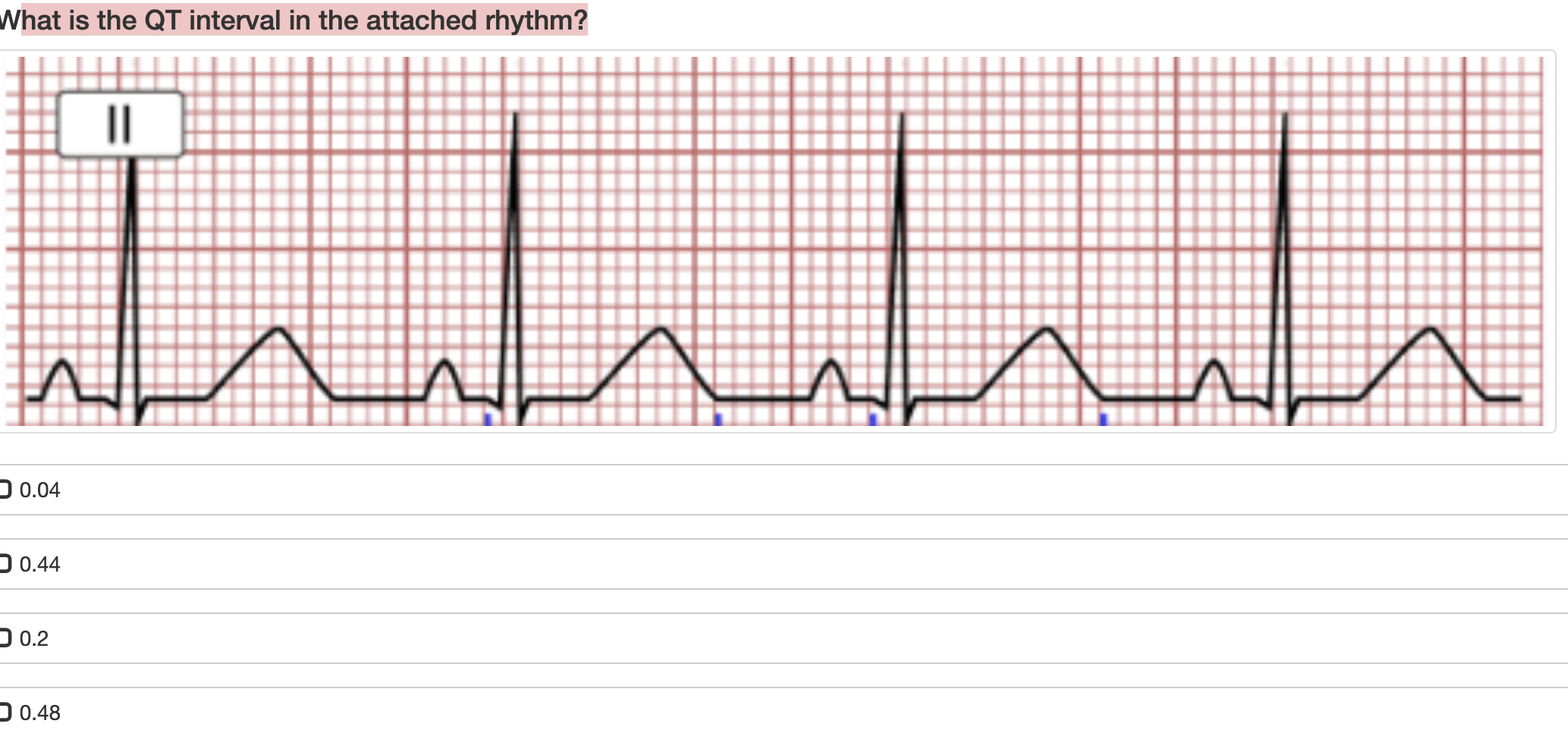 Solved What is the QT interval in the attached | Chegg.com