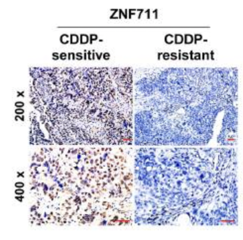 Solved ZNF711 CDDP. CDDP. sensitive resistant 200 x 400 x | Chegg.com