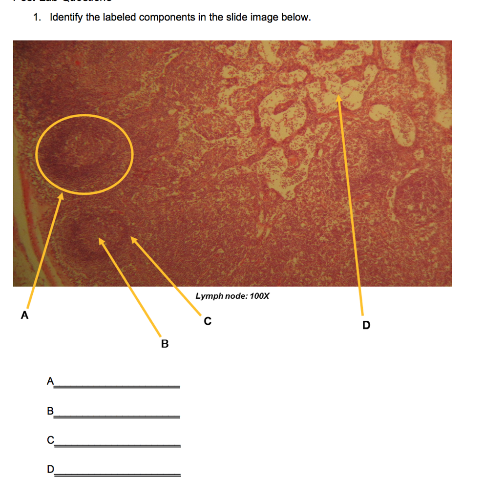 Solved 1. Identify the labeled components in the slide image | Chegg.com