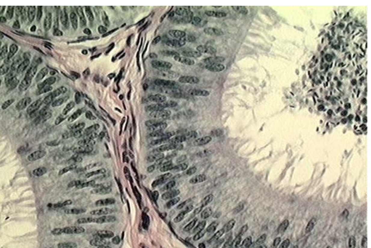Solved What tubular organ, a part of the reproductive | Chegg.com