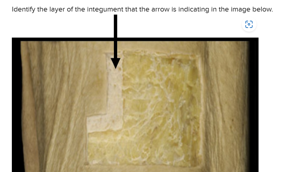 Solved Identify the layer of the integument that the arrow | Chegg.com