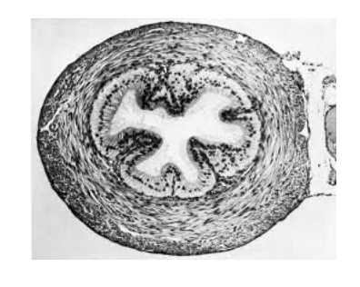 Solved Label the muscle layers and the lumen of this | Chegg.com