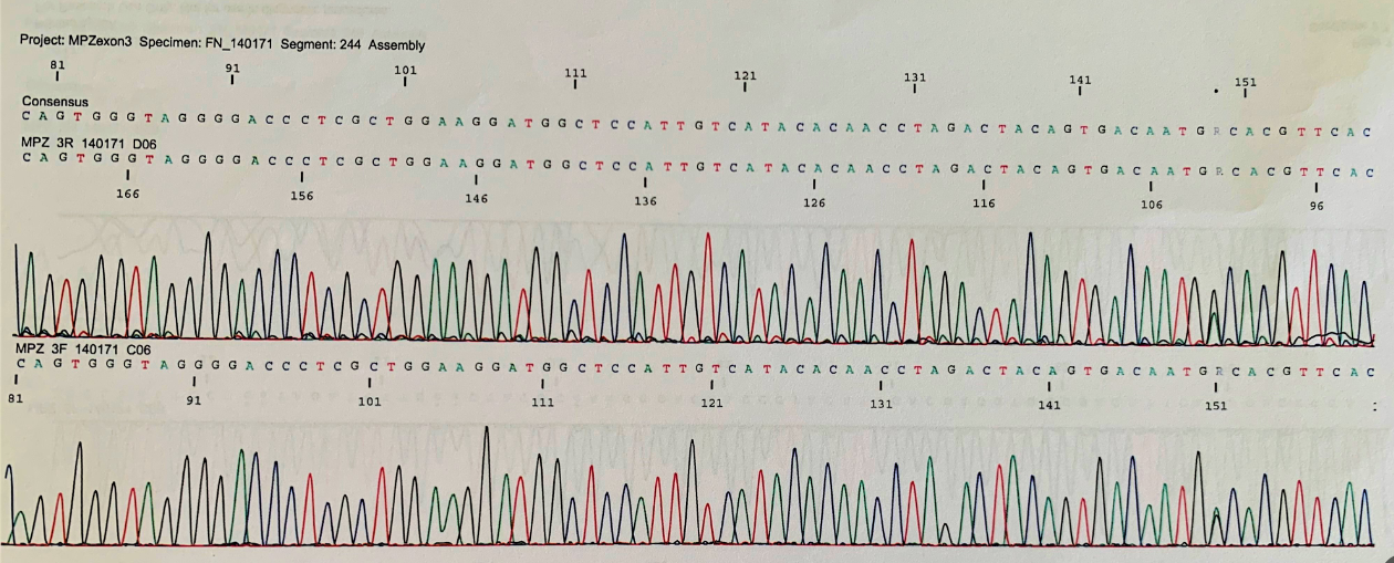 Solved Interpretation of Capillary Electrophoresis Results | Chegg.com