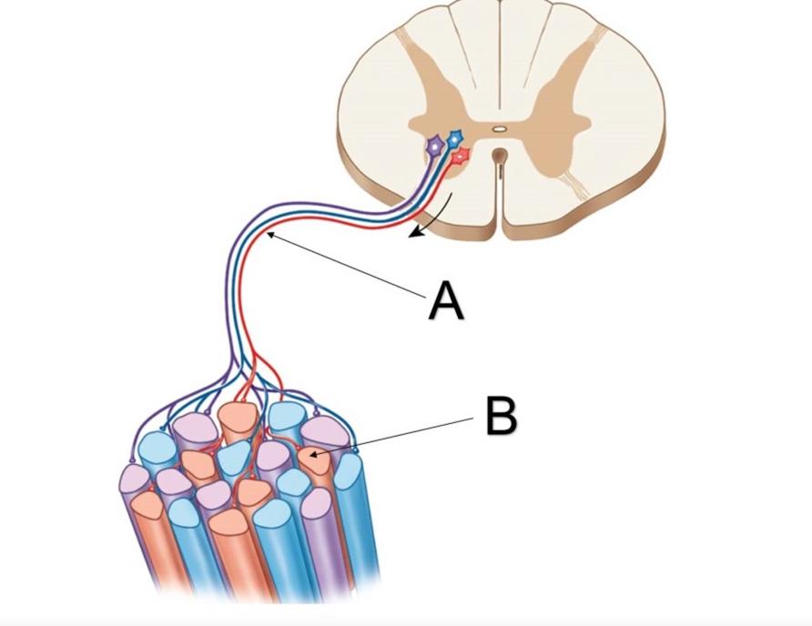 Solved A B What is the name of the structure (red line) | Chegg.com