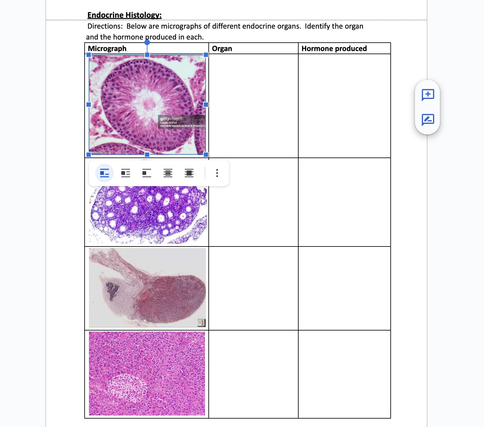 Solved Endocrine Histology:Directions: Below are micrographs | Chegg.com