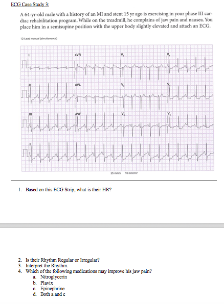 Solved ECG Case Study 3: A 64-yr-old male with a history of | Chegg.com