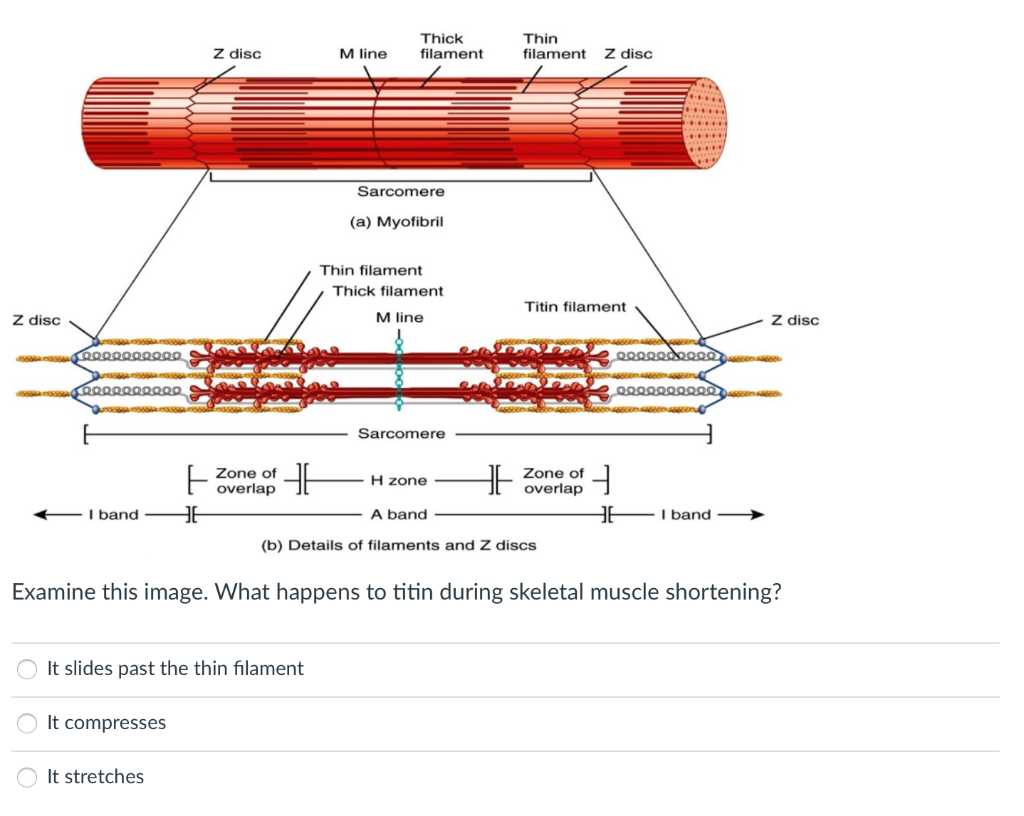 Solved Examine this image. What happens to titin during | Chegg.com