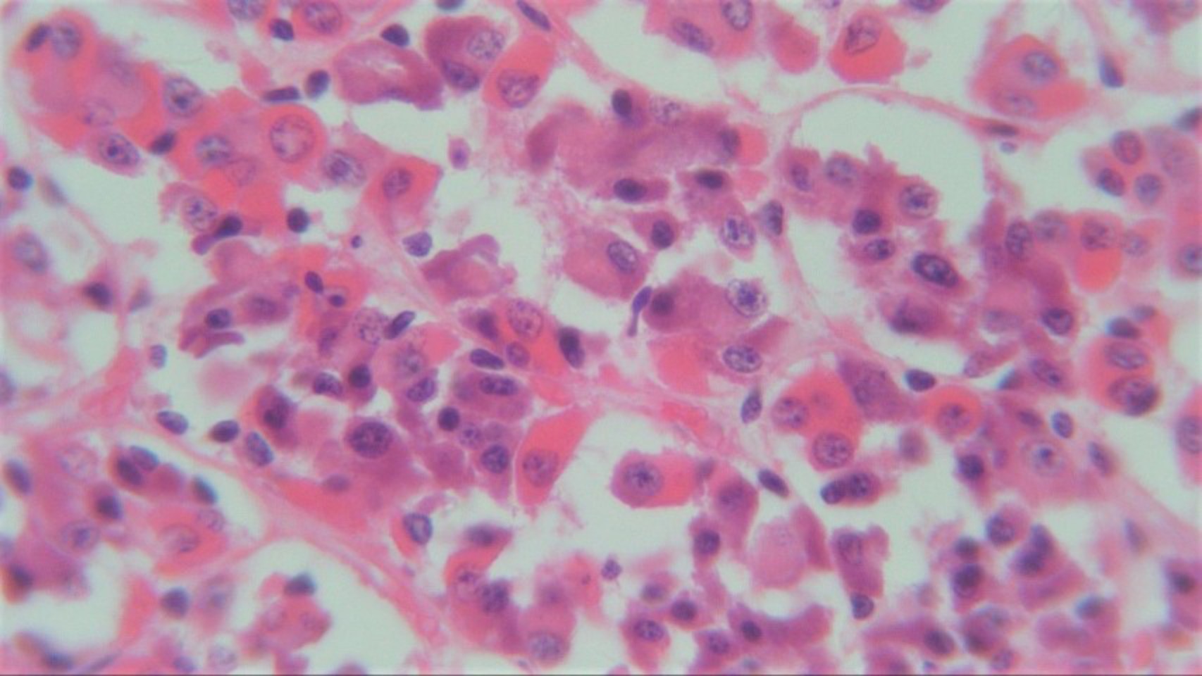 Solved This is a slide of a pituitary gland. Can you please | Chegg.com