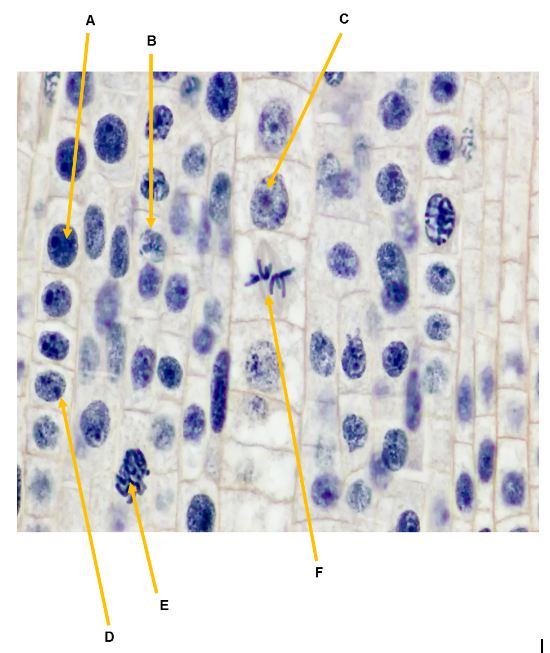 Solved 1. ﻿What stage were most of the onion root tip cells | Chegg.com