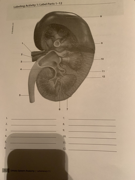 Solved Labeling Activity 3: Parts of a Nephron of Kidney: | Chegg.com