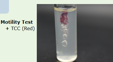 Solved Motility Test a. Growth location (along inoculation | Chegg.com
