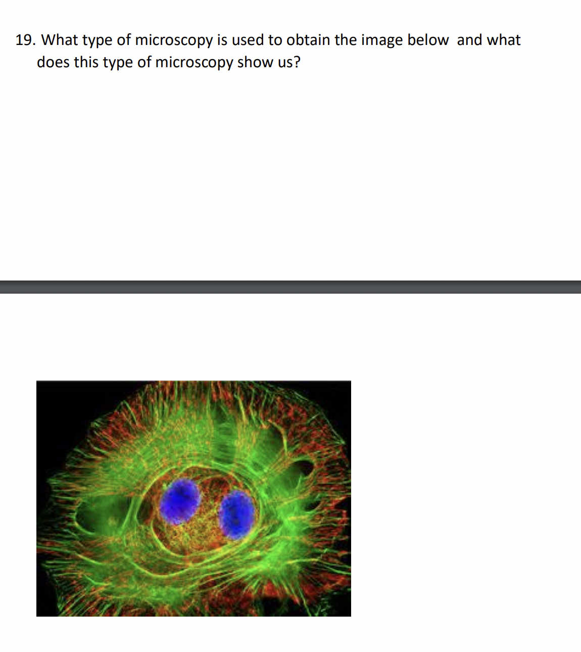 Solved What type of microscopy is used to obtain the image | Chegg.com