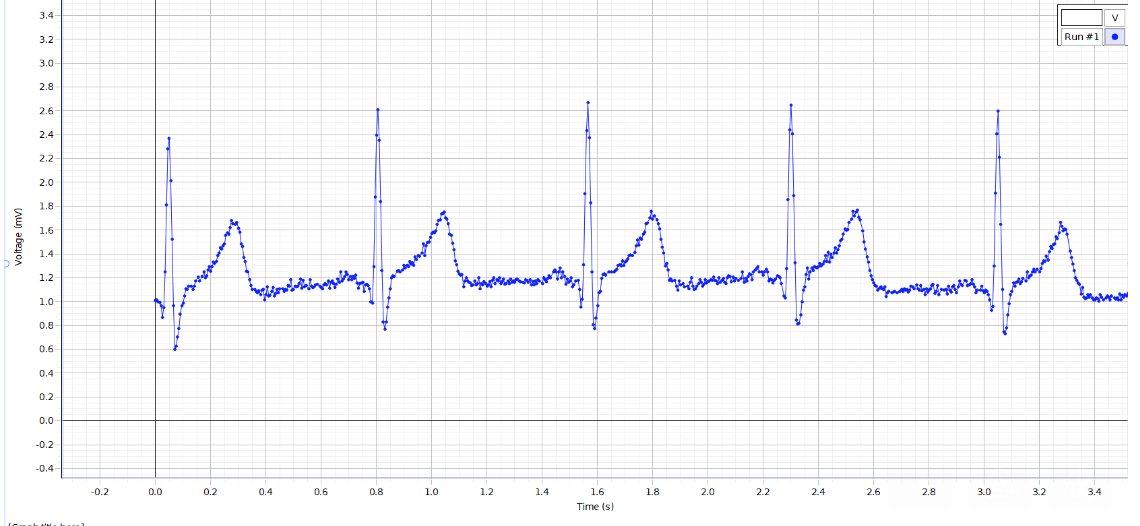 Solved In the EKG above, what was the largest potential | Chegg.com