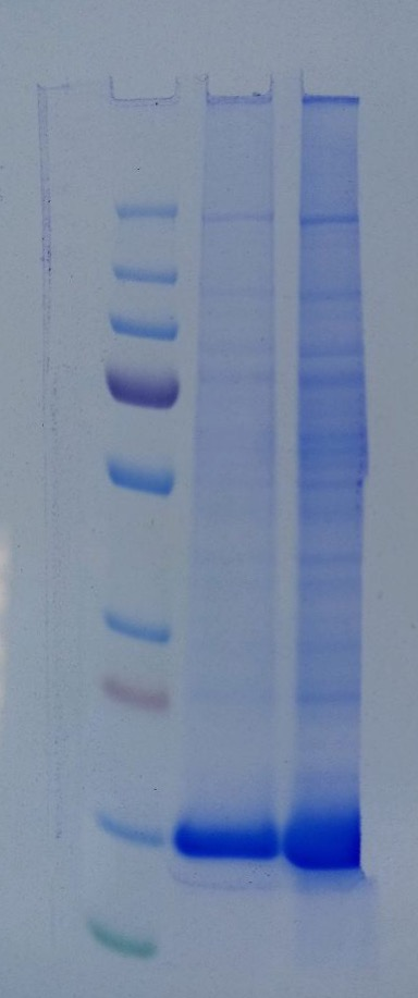 Solved Figure shows Coomassie Blue stained gel. left lane – | Chegg.com