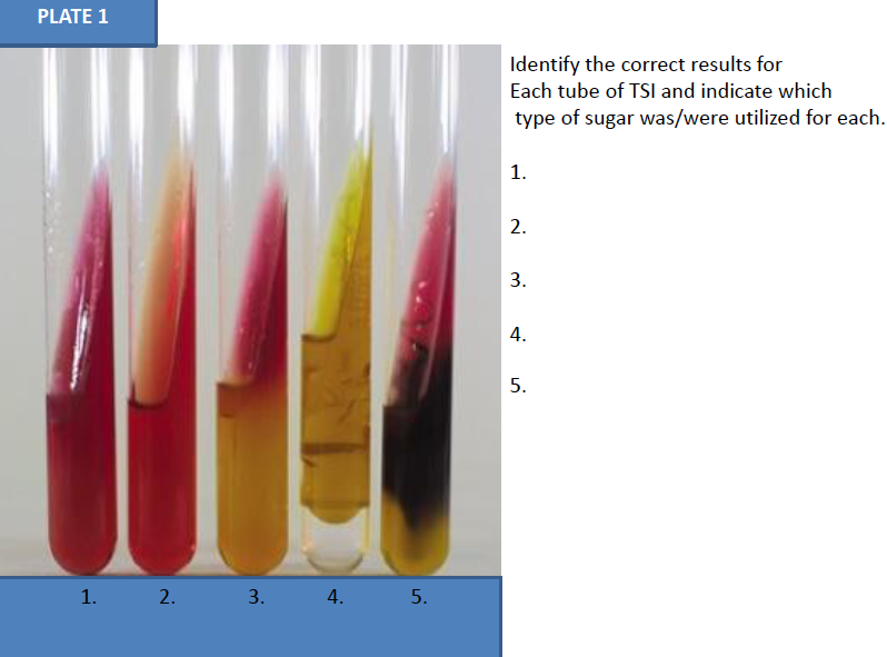 Solved PLATE 1 Identify the correct results for Each tube of | Chegg.com