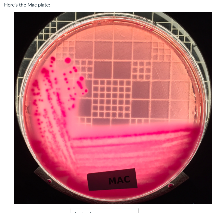 Your team has been given a broth culture of an | Chegg.com