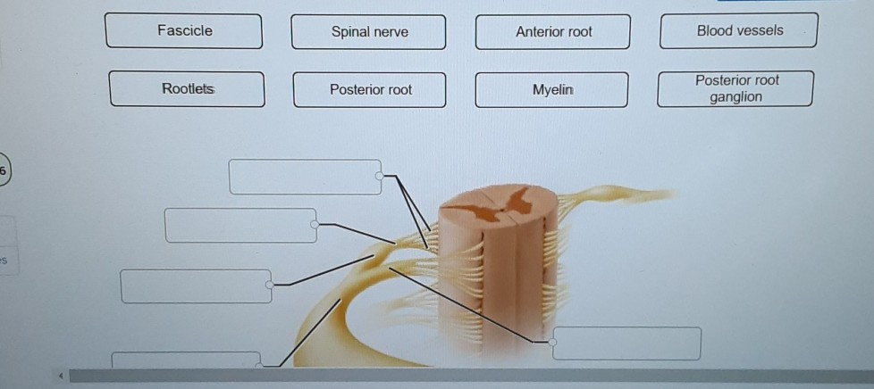 Solved Fascicle Spinal nerve Anterior root Blood vessels | Chegg.com