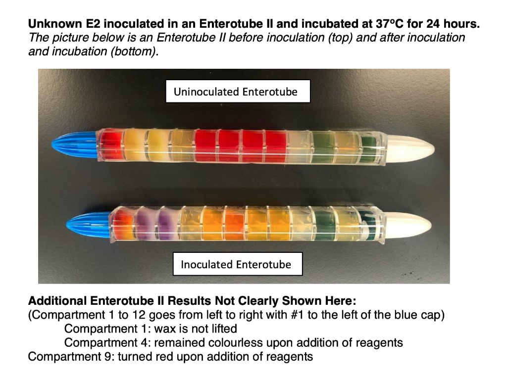 Solved Unknown E2 inoculated in an Enterotube Il and | Chegg.com